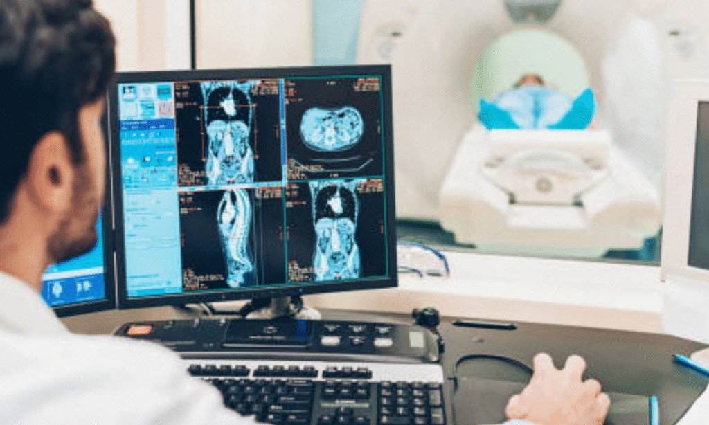 CT KUB Scan: Purpose, Process, and What to Expect